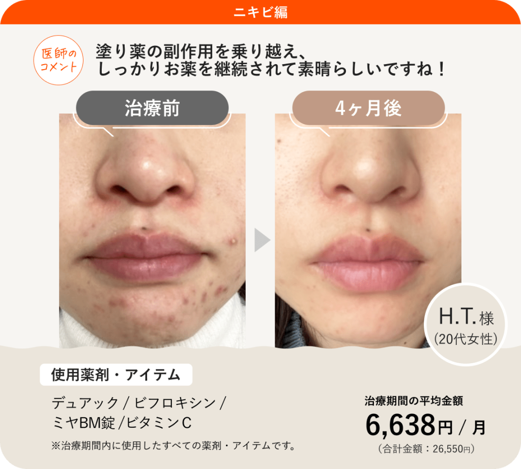ミヤBMが市販薬じゃないって本当？代用できる市販薬も紹介！｜ANS. magazine