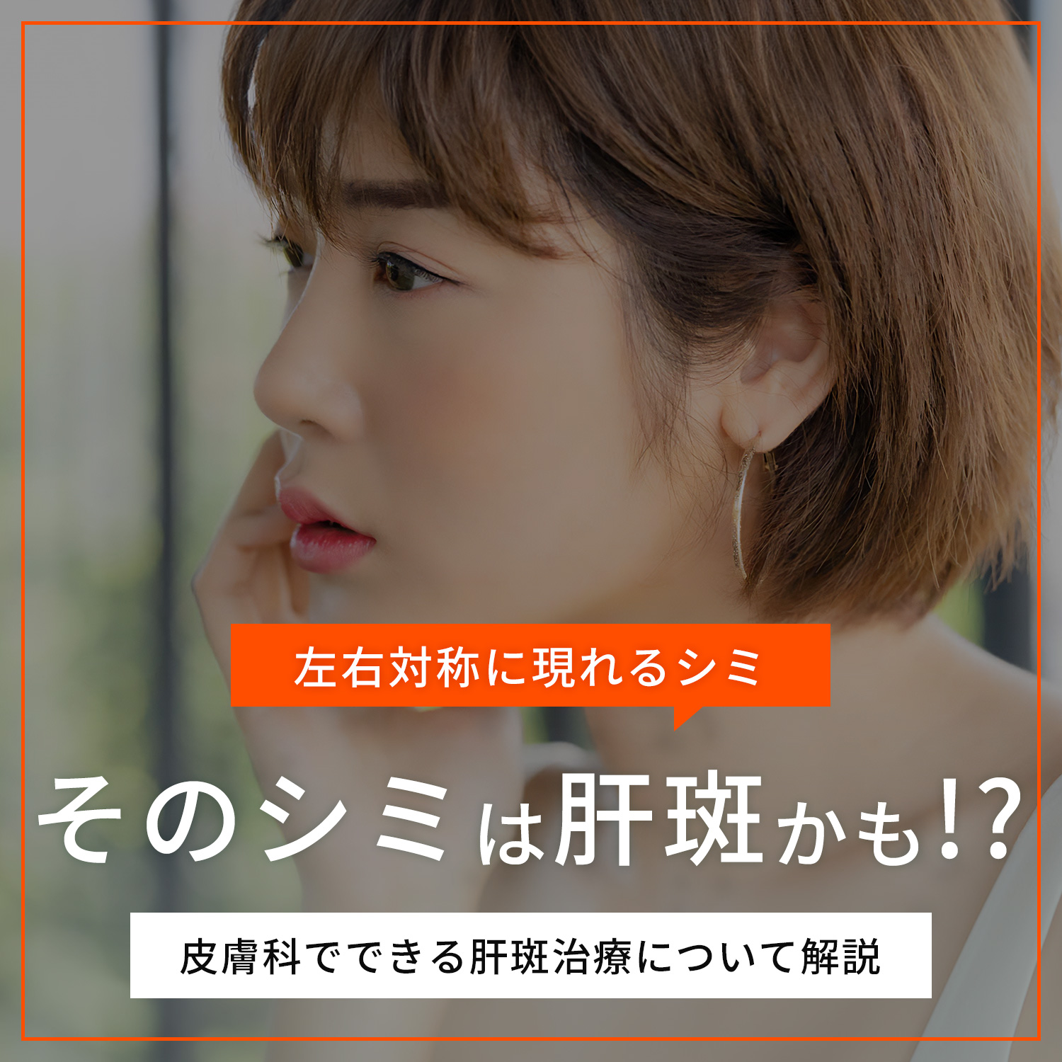 そのシミは肝斑かも！？皮膚科でできる肝斑治療について解説｜ANS. magazine