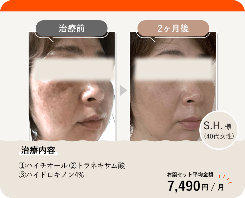 本気で肌を綺麗にしたい方必見！10個のケア方法を徹底解説｜ANS. magazine